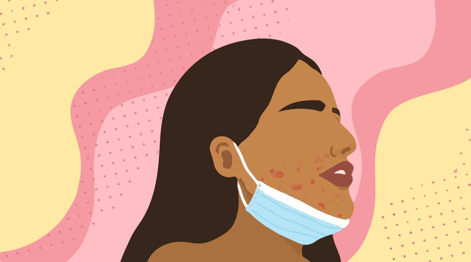 The ‘Maskne’ Struggle is Real!… – Quench Botanics